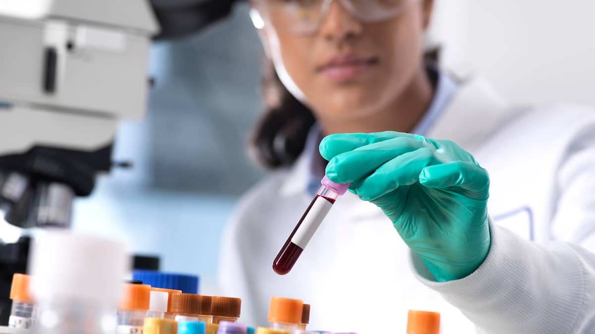 Blutwerte: Wie man die Laborwerte richtig verstehen lernt | Beobachter
