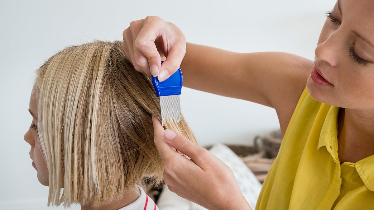 Wie Sie Kopfläuse entdecken | Beobachter