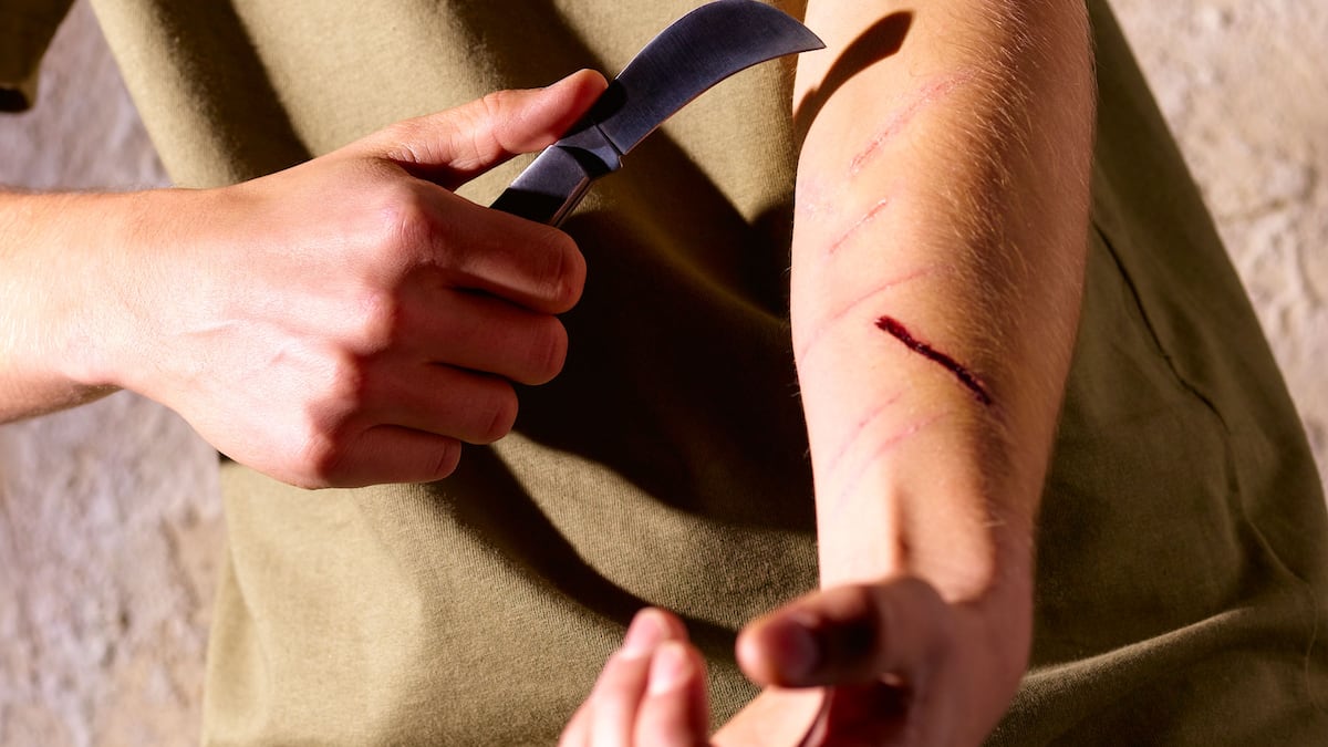 «Meine Tochter ritzt sich» | Beobachter